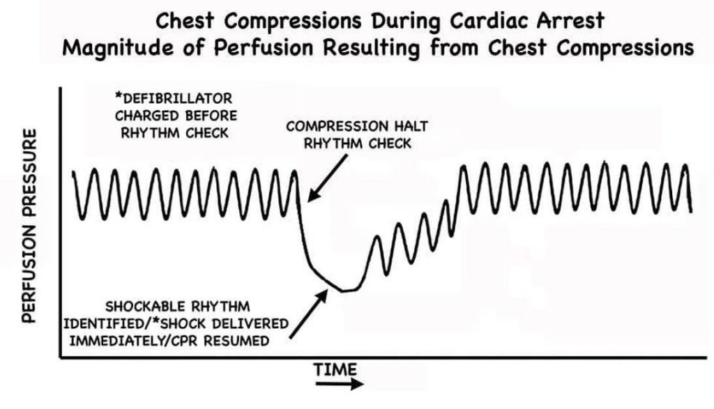 Optimizing Chest Compression Fraction in Cardiopulmonary Resuscitation ...
