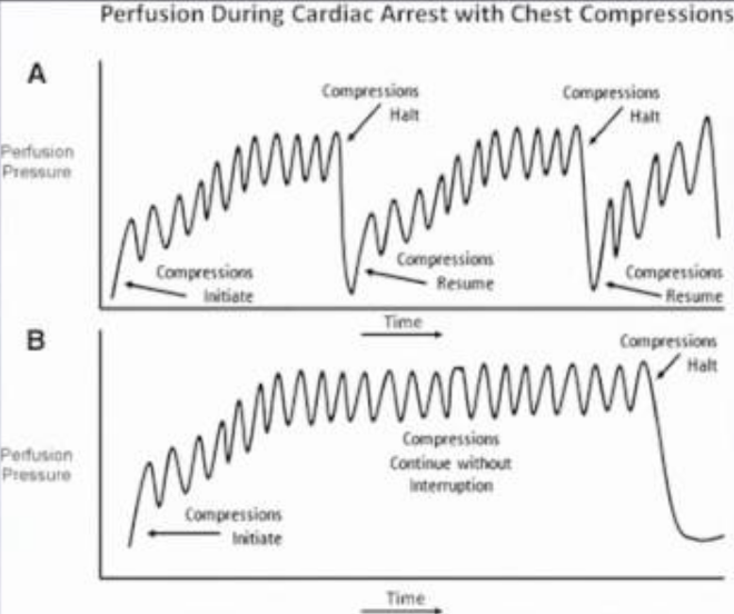 Optimizing Chest Compression Fraction in Cardiopulmonary Resuscitation: Strategies and Clinical ...